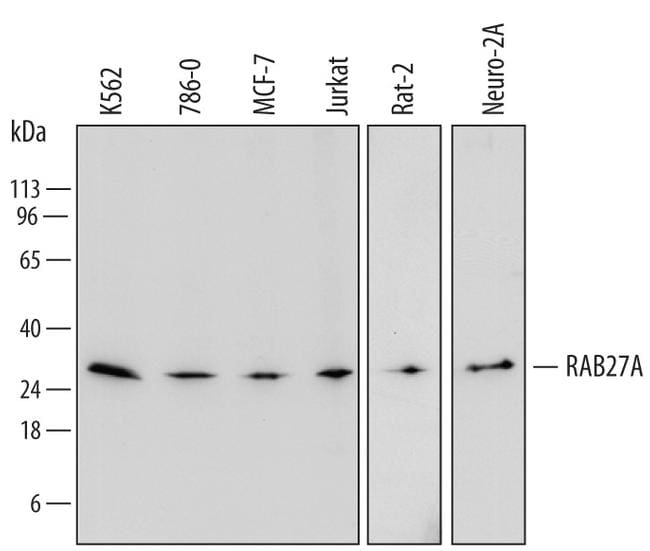RAB27A Antibody (PA5-47907)