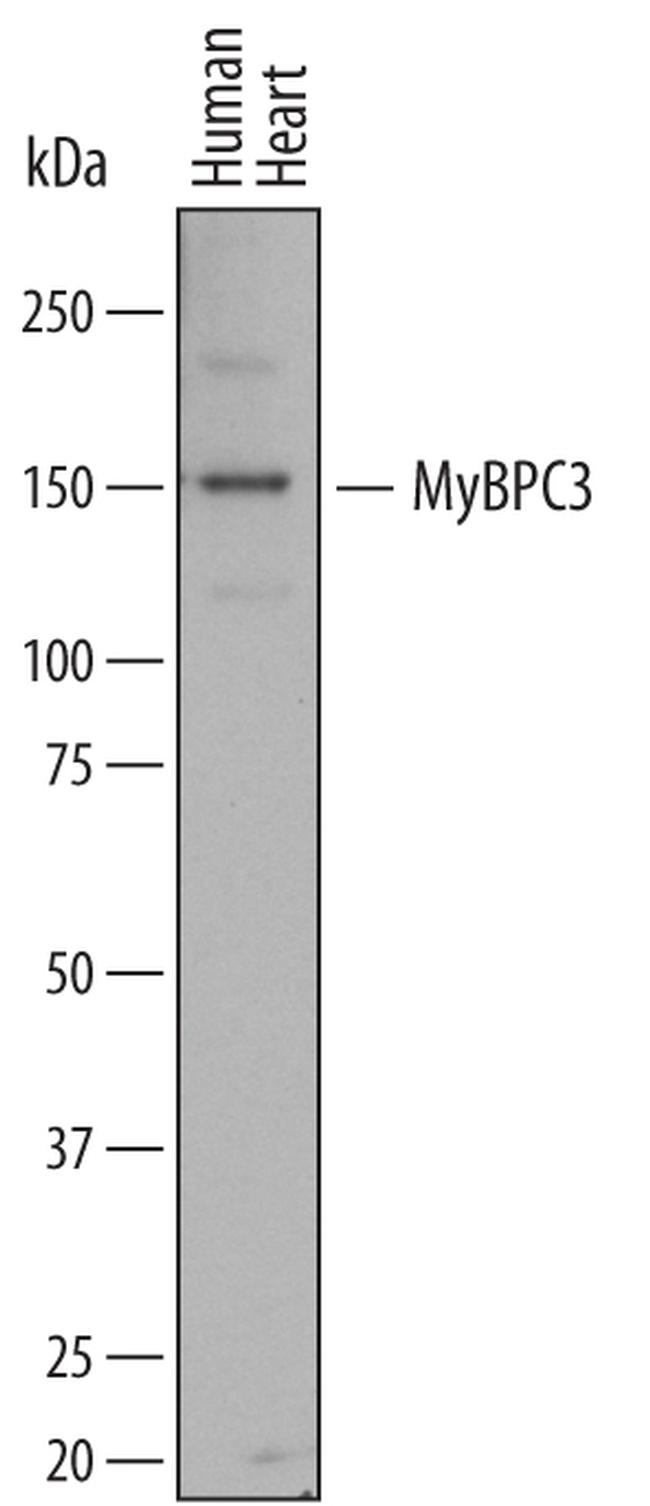 MYBPC3 Antibody (PA5-47925)