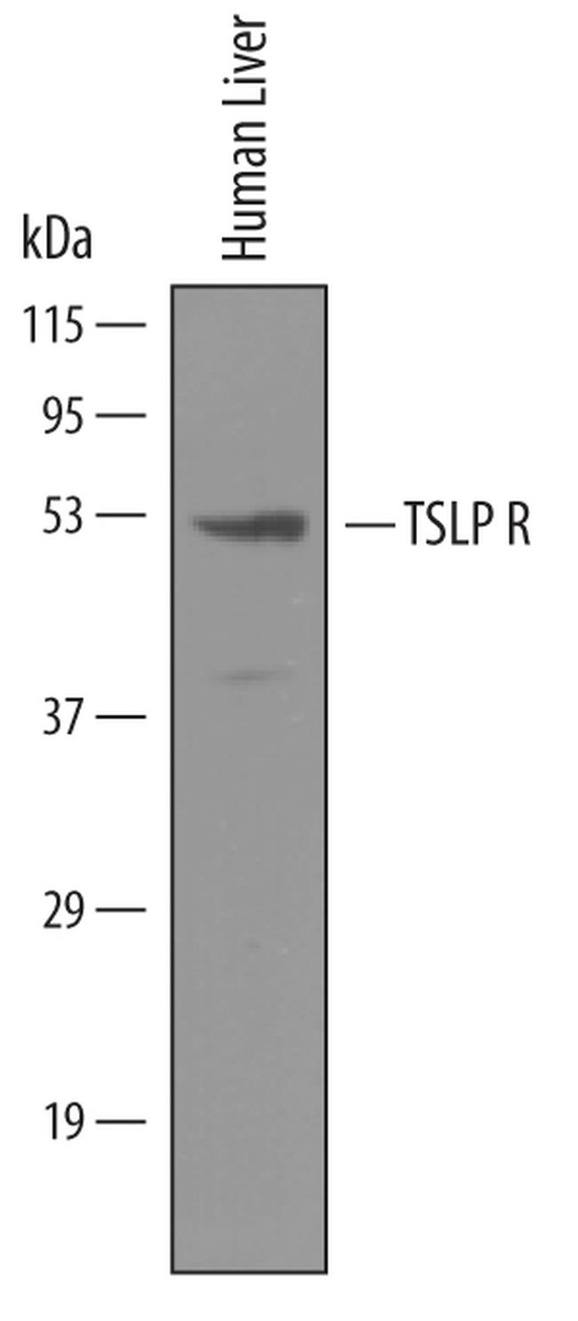 TSLP Receptor Antibody (PA5-47979)
