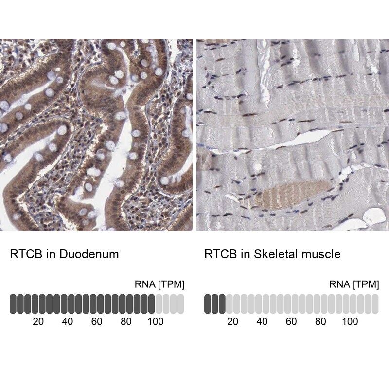 RTCB Antibody (PA5-51512)