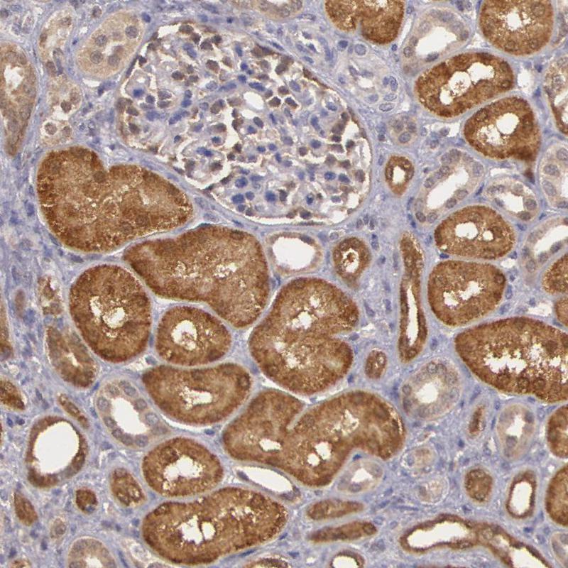 MPST Antibody (PA5-51548)