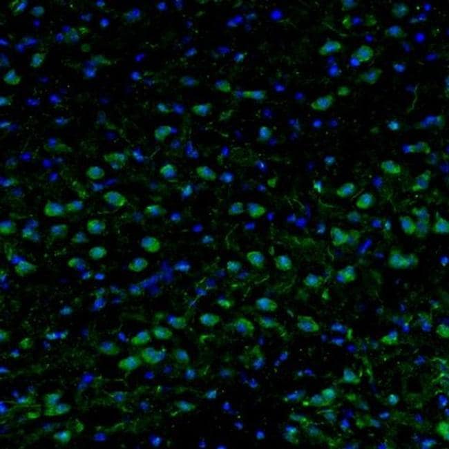 Njmu-R1 Antibody (PA5-52046)