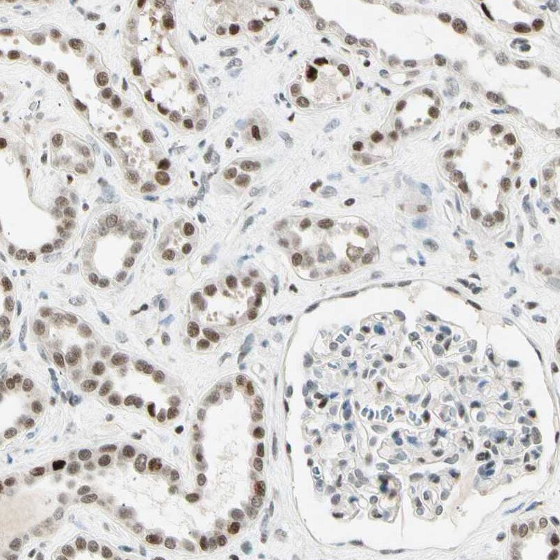 RNF43 Antibody (PA5-52512)