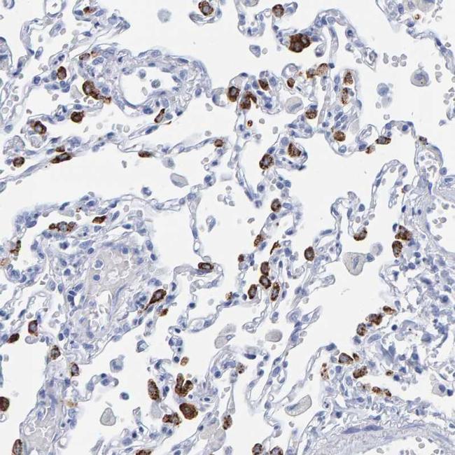 Anti-SFTPC Antibodies | Invitrogen