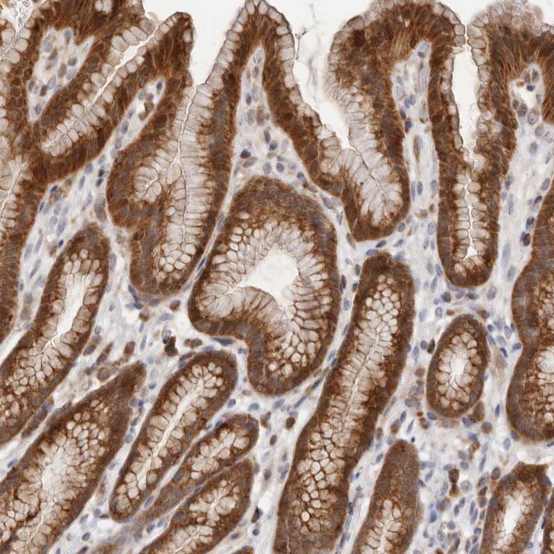 RNF213 Antibody (PA5-55418)