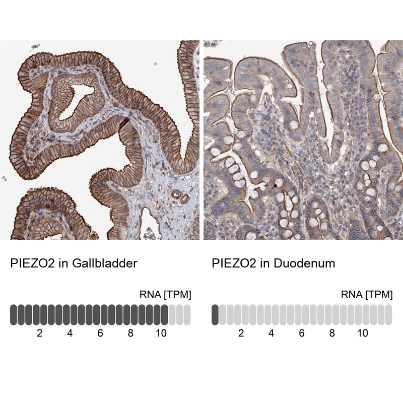 PIEZO2 Antibody (PA5-56894)