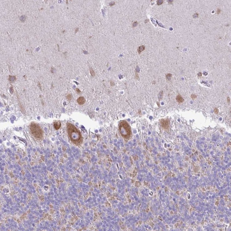 Pellino 3 Antibody (PA5-58573) Pellino 3 Antibody (PA5-58573)