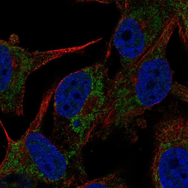 CMPK2 Antibody (PA5-59570)