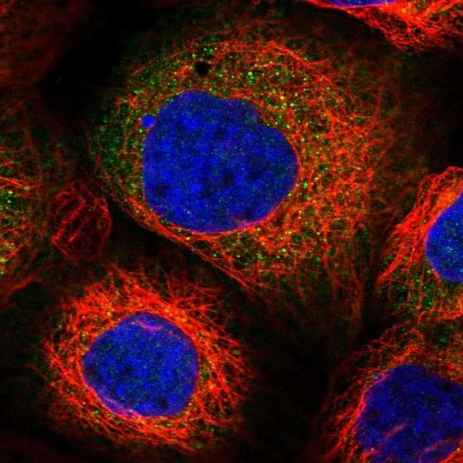 PPP2R2A/PPP2R2B Antibody (PA5-59878)