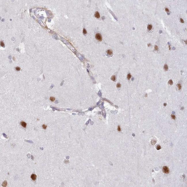 DPF1 Antibody (PA5-61895)