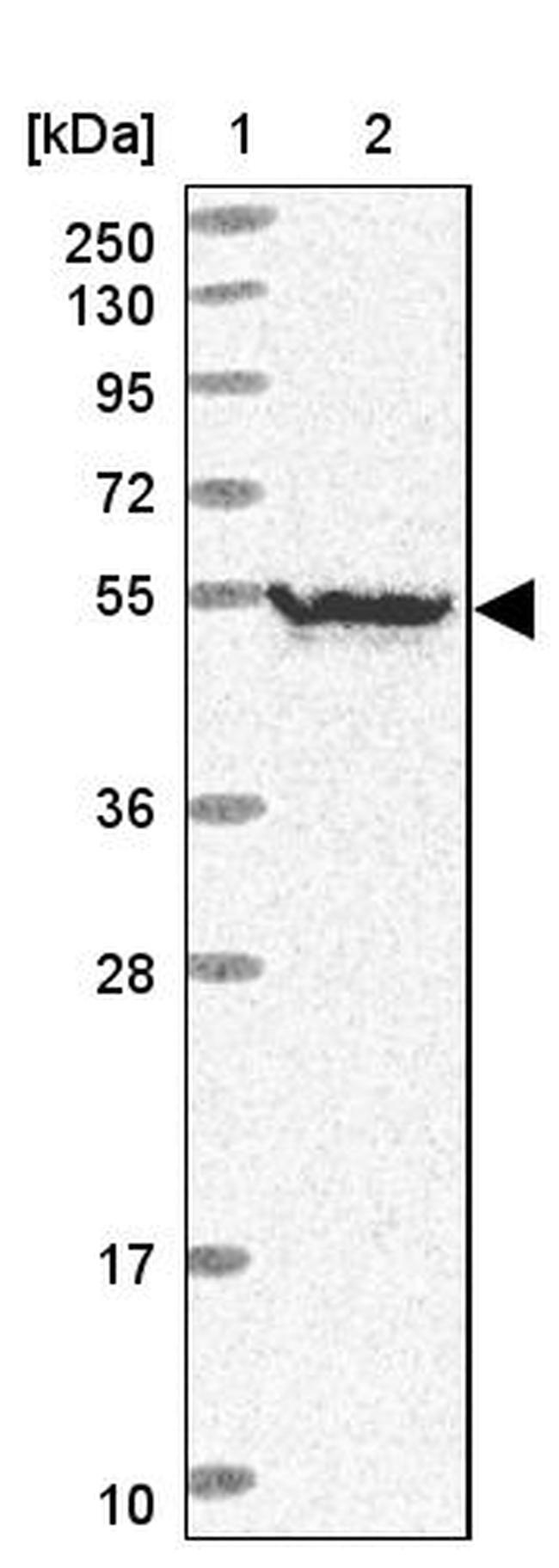 DPF1 Antibody (PA5-61895)