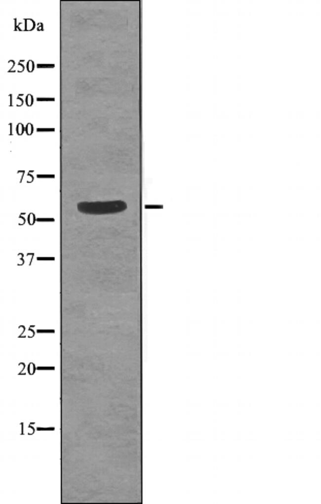 Phospho Tgfbr1 Thr204 Antibody Pa5 64809