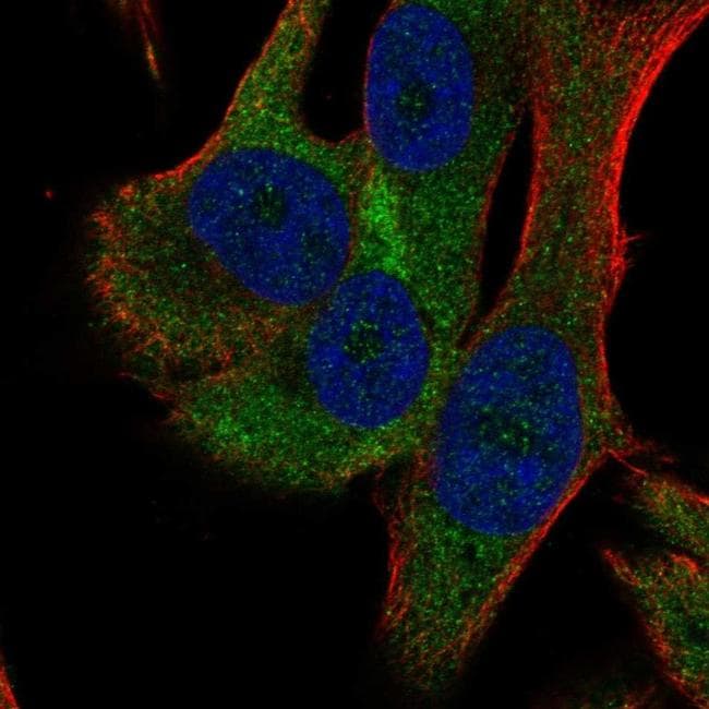 RPS18 Antibody (PA5-65916)