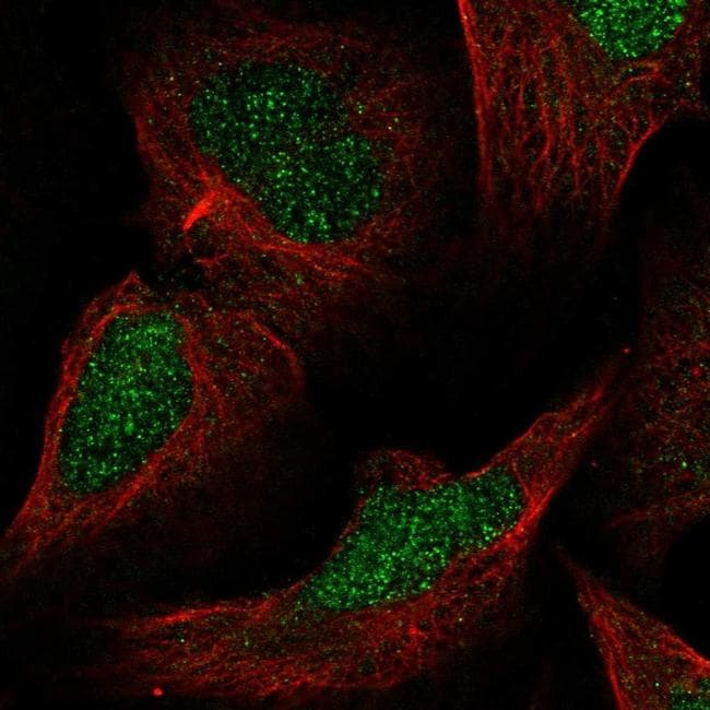 MLH3 Antibody (PA5-66338)
