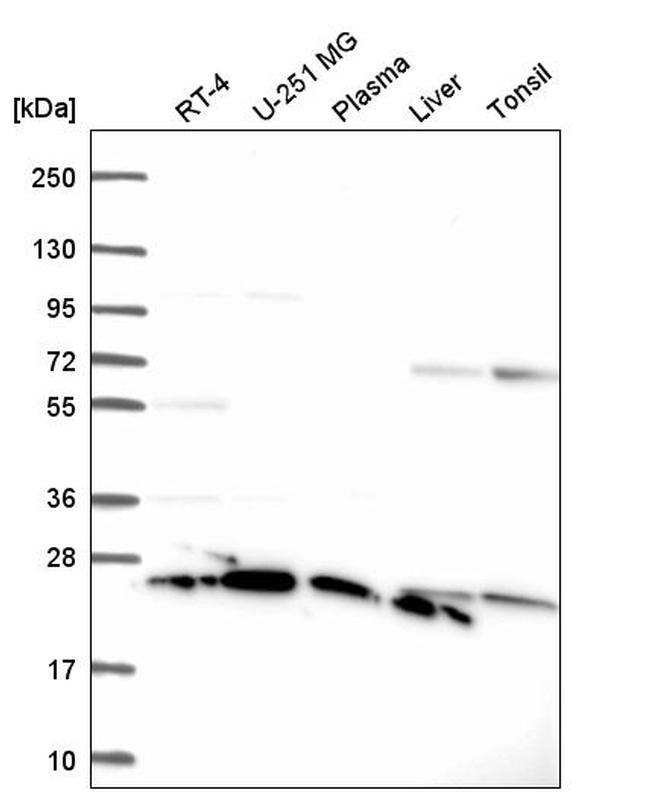 RPS5 Antibody (PA5-66442)