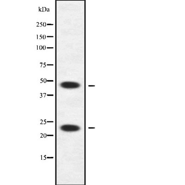 APOBEC3A/APOBEC3B Antibody (PA5-68281)