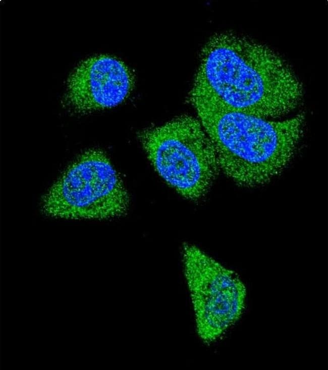 Complement C6 Antibody (PA5-72500)