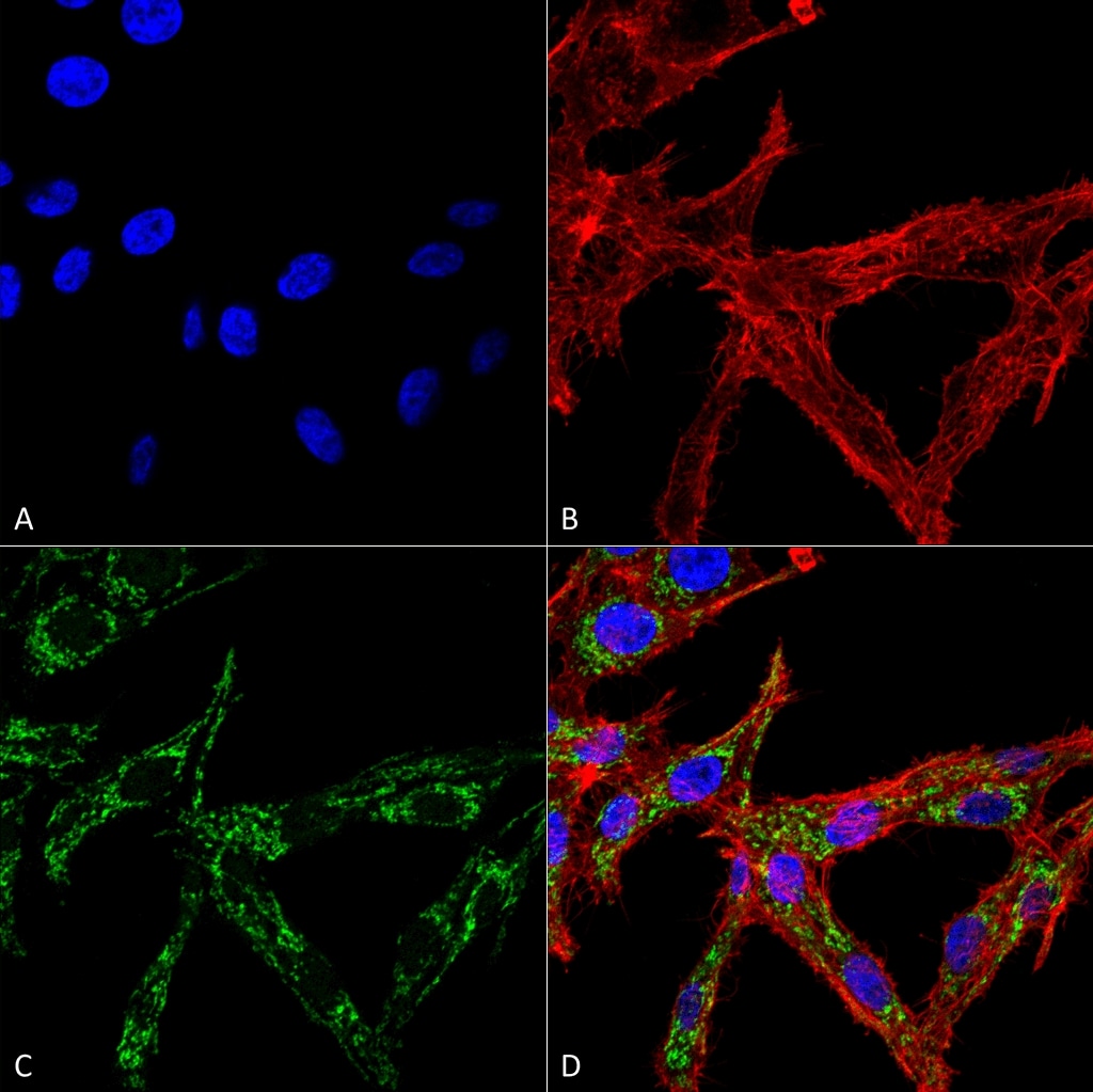 HSF2 Antibody (PA5-77831)