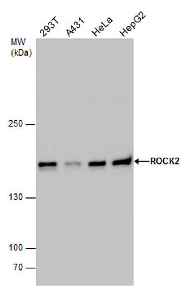 ROCK2 Antibody (PA5-78290)