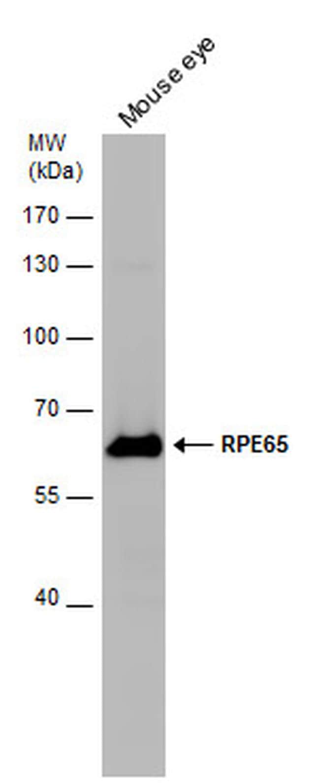 RPE65 Antibody (PA5-78414)