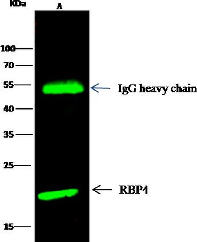 RBP4 Antibody (PA5-80916)