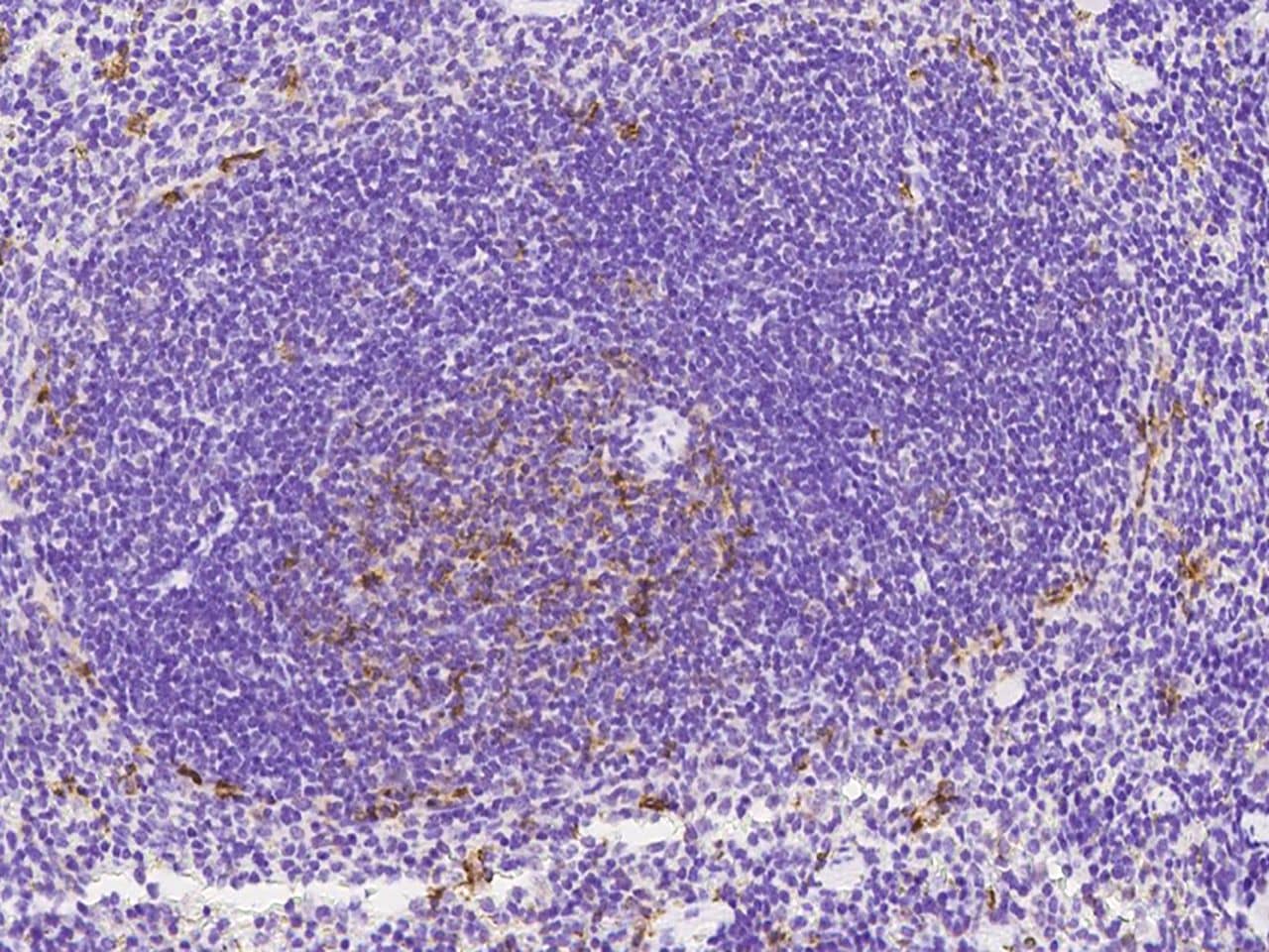 CD8 alpha Antibody (PA5-81344) CD8 alpha Antibody (PA5-81344)