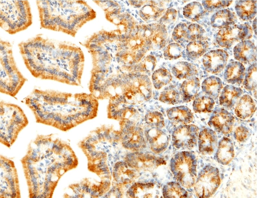Hsp60 Antibody Pa5 81403