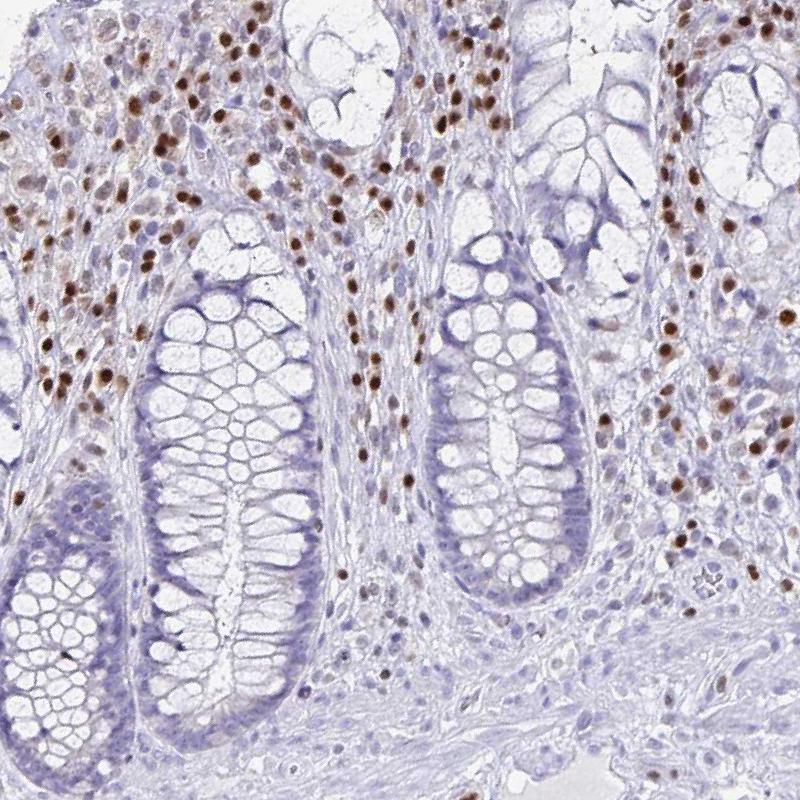RUNX2 Antibody (PA5-82787)