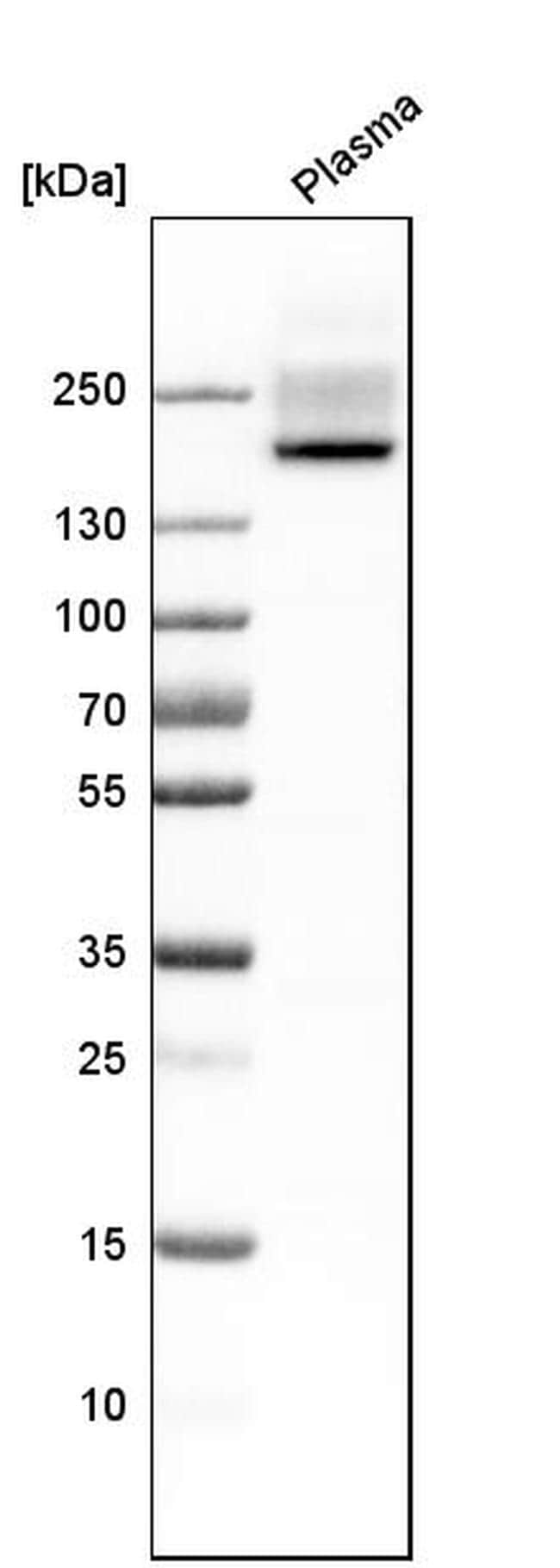 Complement Factor H Antibody (PA5-83957)