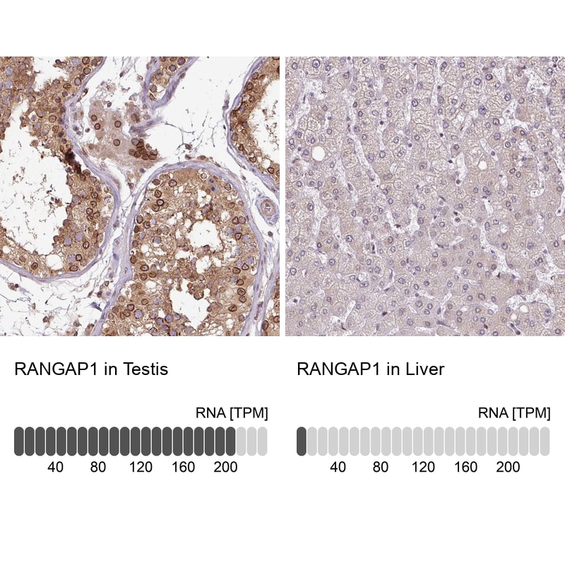 RANGAP1 Antibody (PA5-83992)
