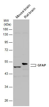 GFAP Antibody (PA5-85261)