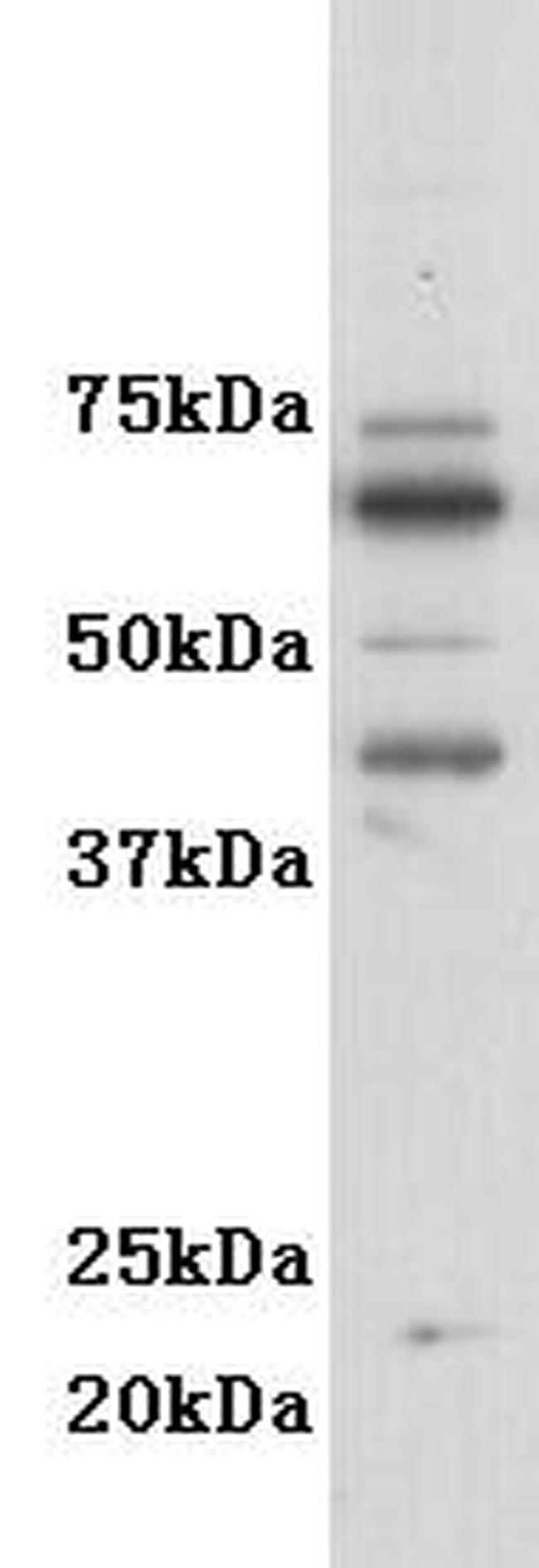 CD116 Antibody (PA5-85872)