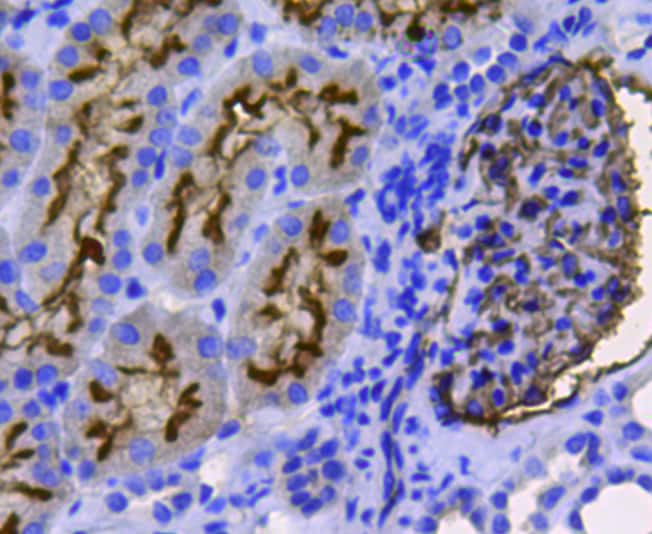 CD10 Antibody (PA5-85875)