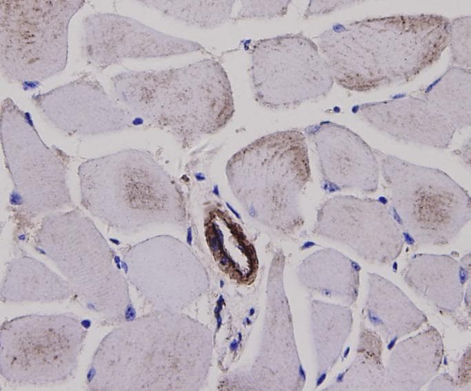 Alpha-Smooth Muscle Actin Antibody (PA5-85919)