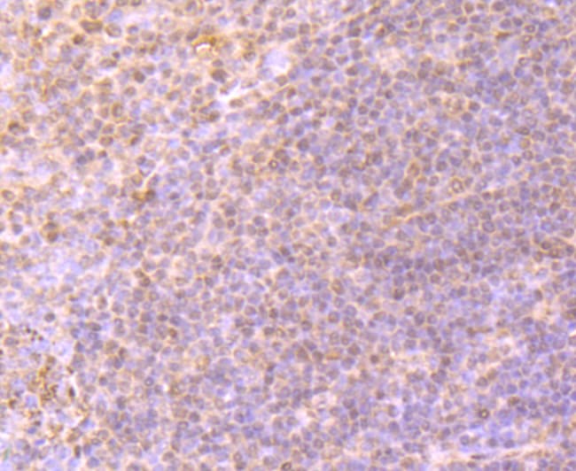 CD61 (Integrin beta 3) Antibody (PA5-85926)