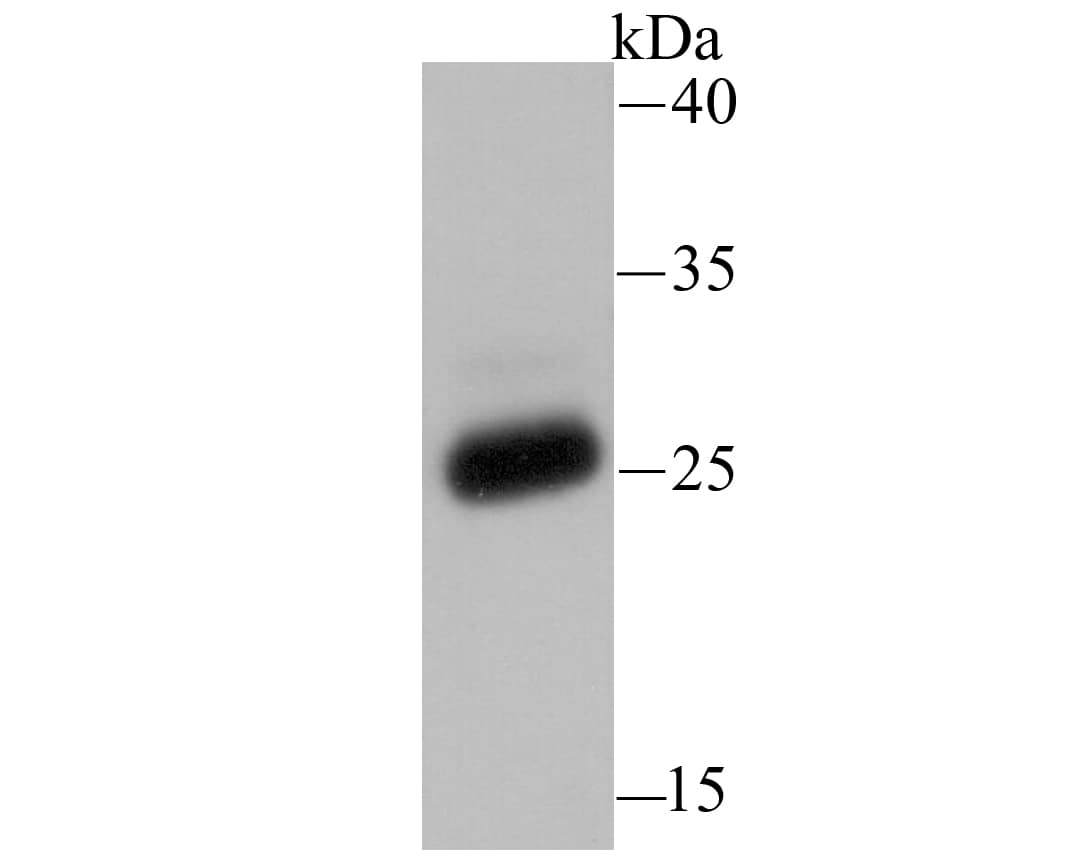 PR3 Antibody (PA5-85928)