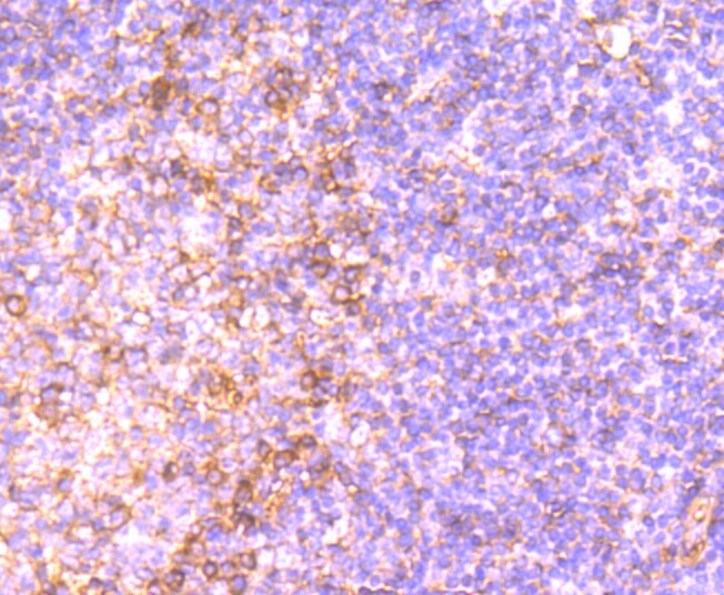Human IgM Antibody (PA5-86030)