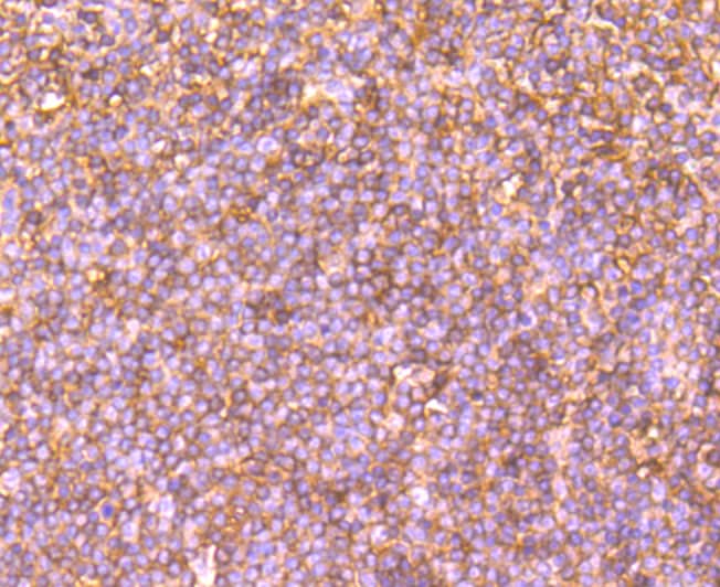 Human IgM Antibody (PA5-86030)