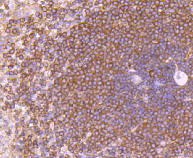 TIM-3 Antibody (PA5-86067)