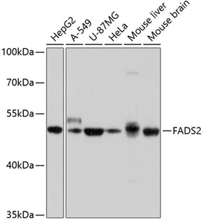 FADS2 Antibody (PA5-87765)