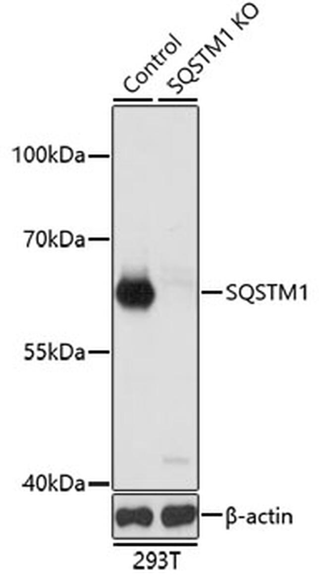 SQSTM1 Antibody