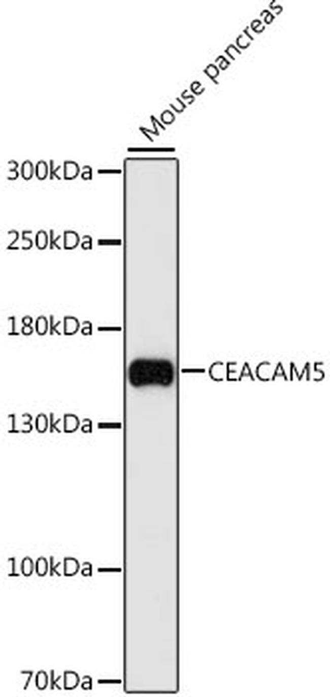 CEACAM5 Antibody (PA5-88533)