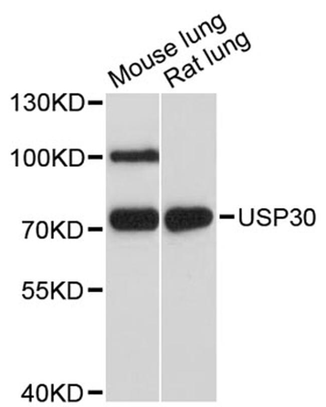 Anti-USP30 Antibodies | Invitrogen
