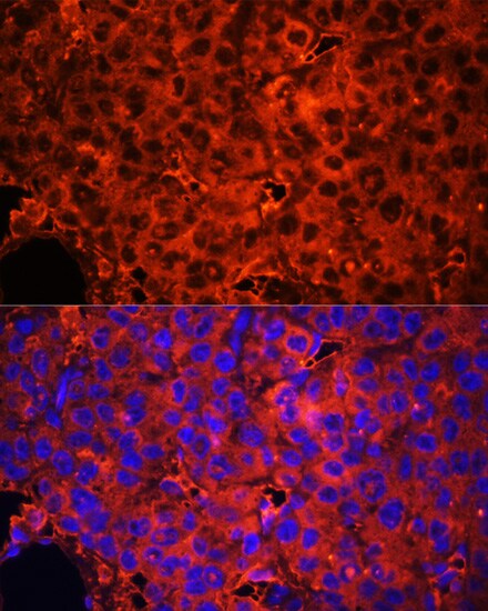 Complement C3 Antibody (PA5-89132)