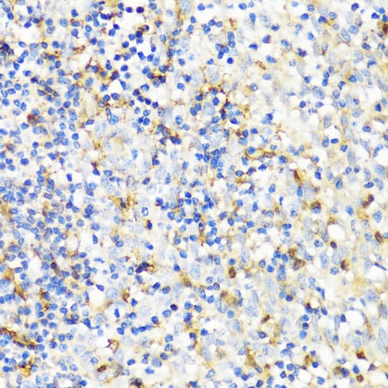 CD11c Antibody (PA5-90208)