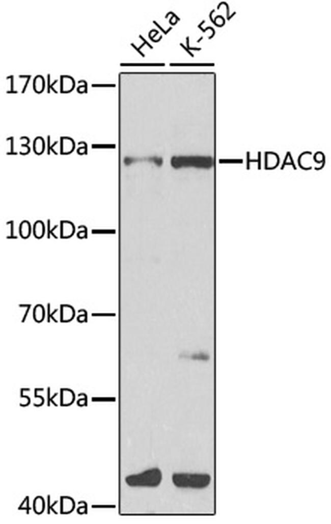 HDAC9 Antibody (PA5-90264)