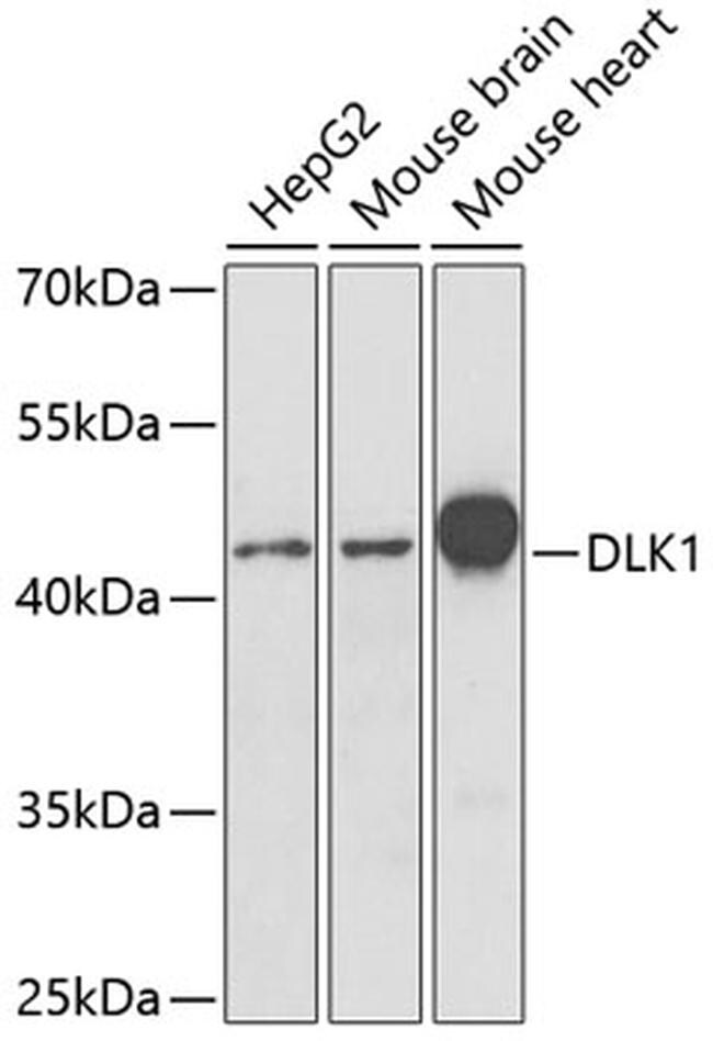 DLK1 Antibody (PA5-93073)