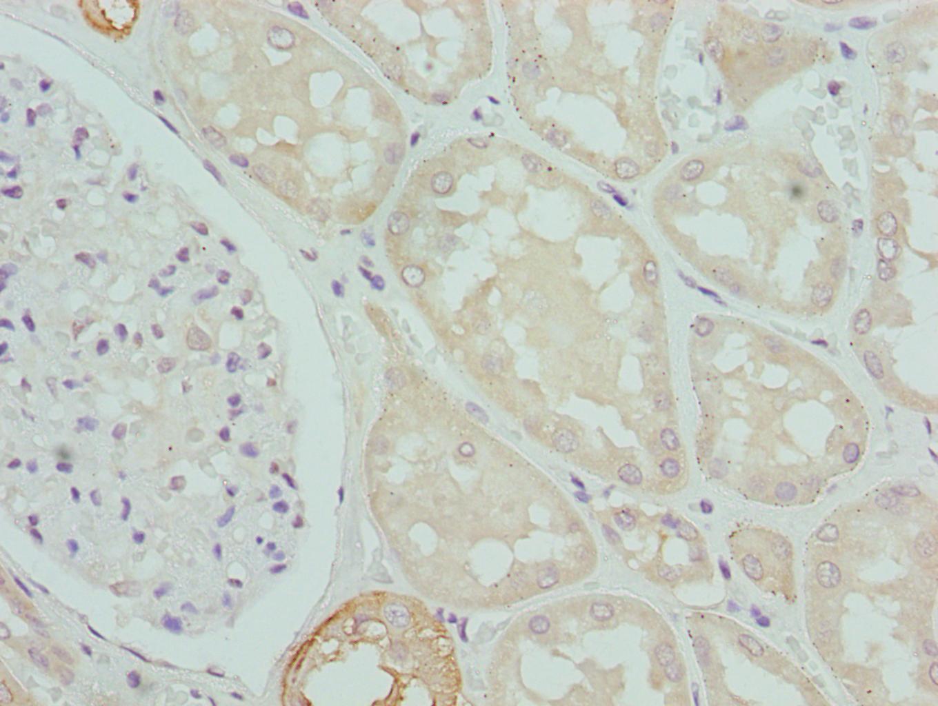 CPN1 Antibody (PA5-97611)