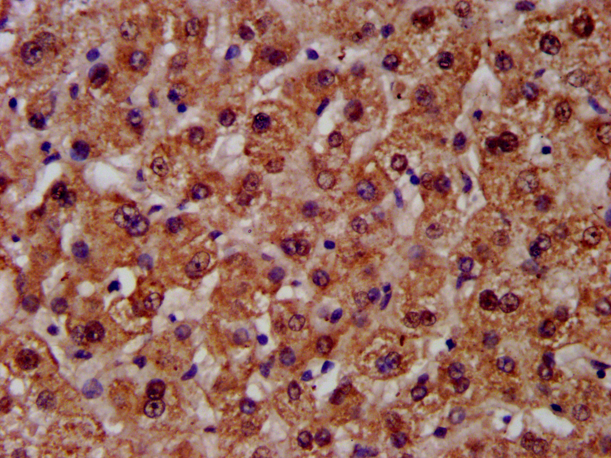 CPS1 Antibody (PA5-97614)