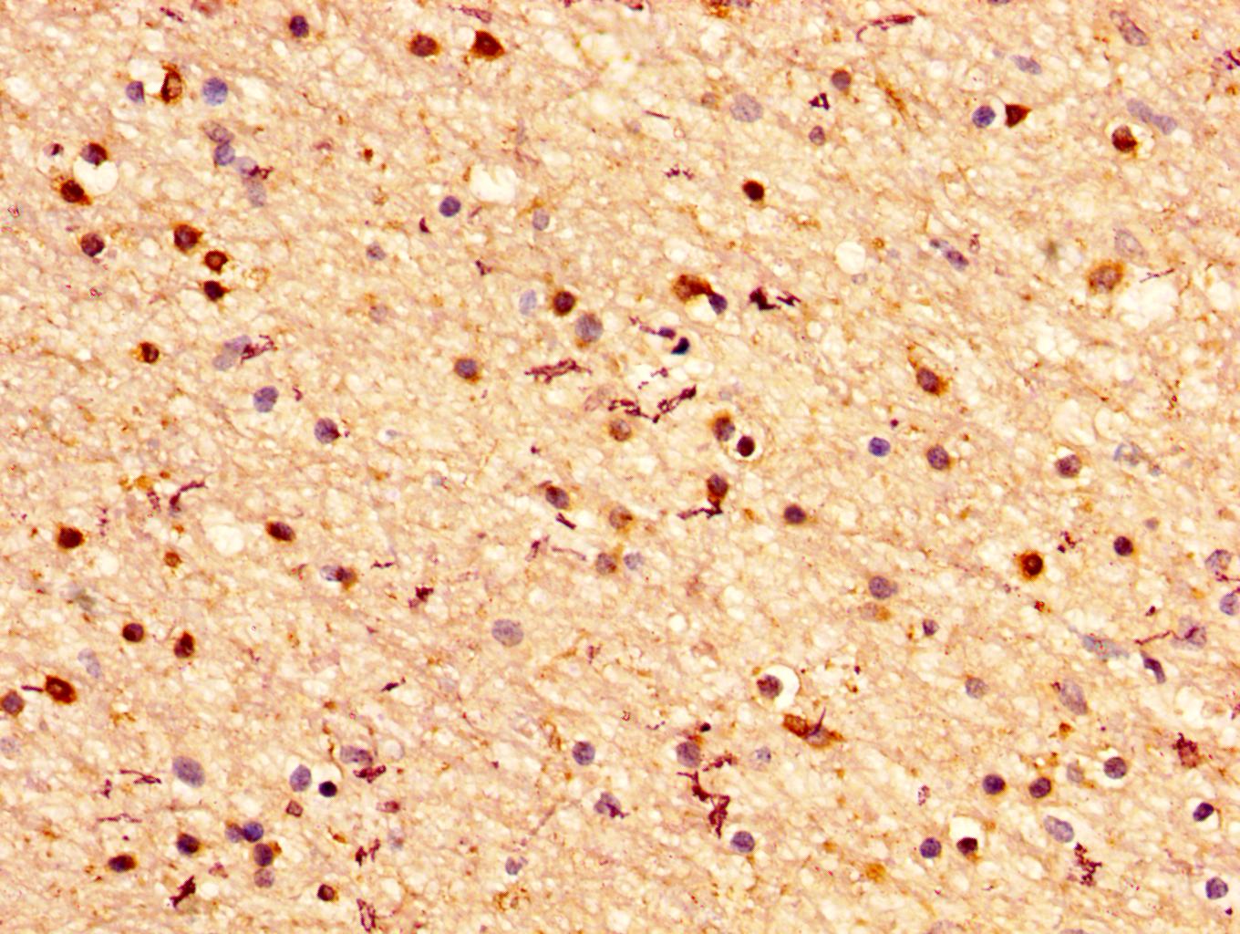 CRYAB Antibody (PA5-97626)